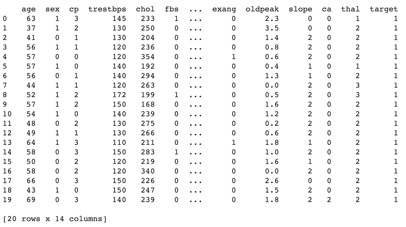Heart Disease Prediction Using Keras Deep Learning